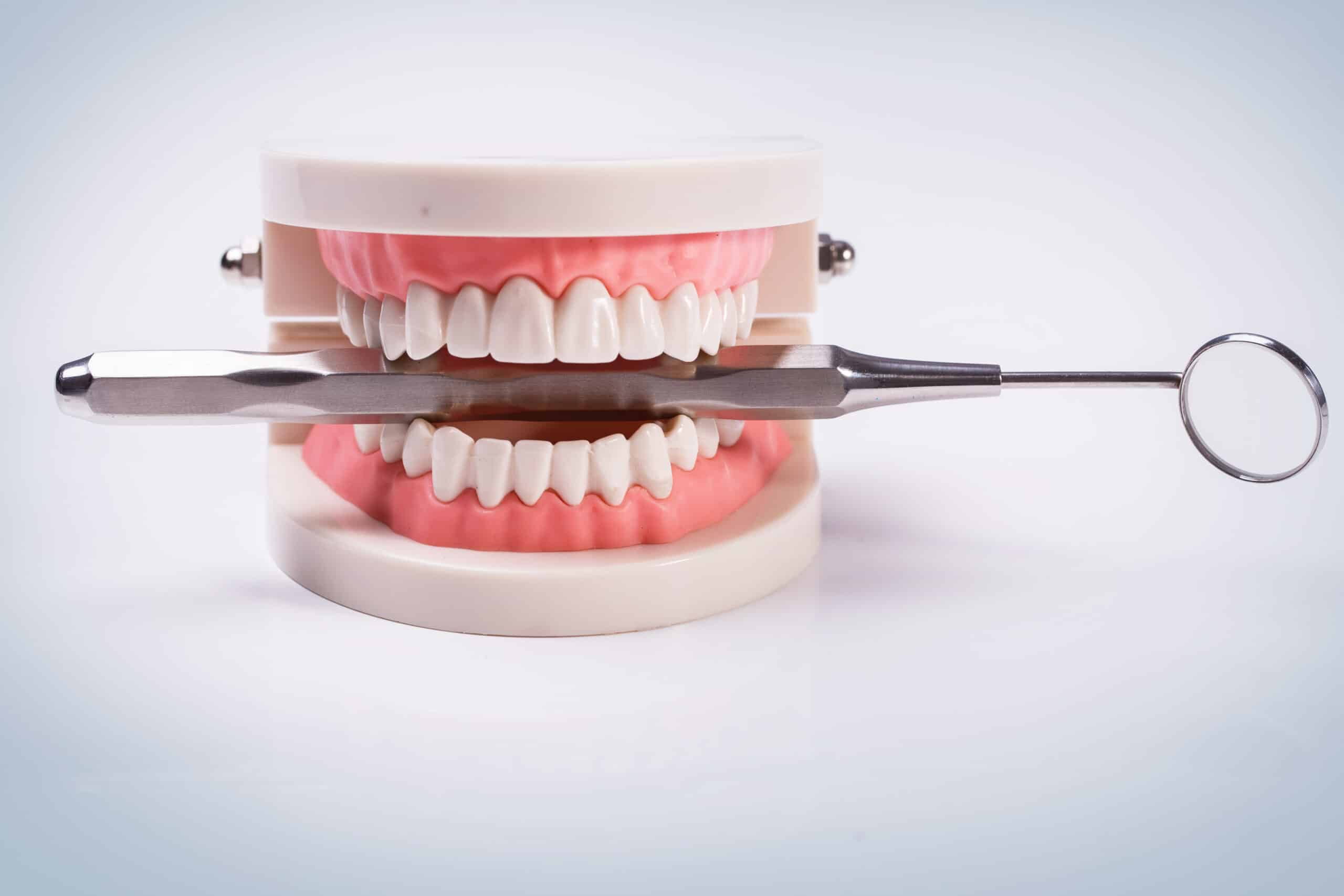 A Guide To Overdentures: Uses And Benefits
