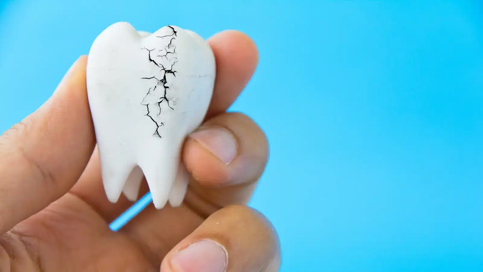 What Happens When A Cracked Tooth Goes Untreated? - North Frisco Dental ...